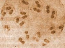 Simbiotiese stikstofbinding - Bladsye [1] - Wêreld ensiklopediese kennis