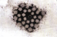 Virus-infeksie - Bladsye [1] - Wêreld ensiklopediese kennis