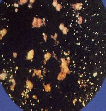 Chlamydia trachomatis - Bladsye [2] - Wêreld ensiklopediese kennis