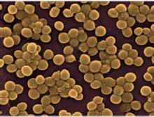 Tandheelkundige infeksies - Bladsye [1] - Wêreld ensiklopediese kennis