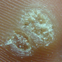 Soolvratte - Bladsye [1] - Wêreld ensiklopediese kennis