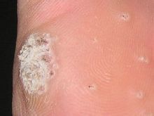 Soolvratte - Bladsye [1] - Wêreld ensiklopediese kennis