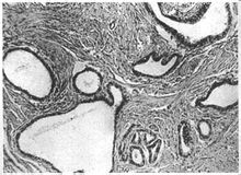 Oophoritis - Bladsye [1] - Wêreld ensiklopediese kennis