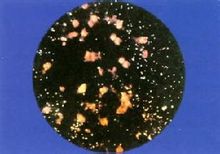 Chlamydia trachomatis - Bladsye [2] - Wêreld ensiklopediese kennis